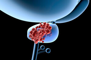 Rak prostate / Centri A-Z - Cybermed.hr